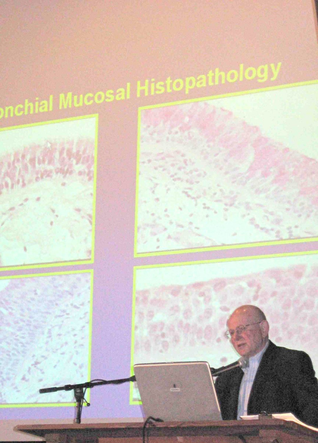 Tashkin on Cannabis and COPD | O'Shaughnessy's